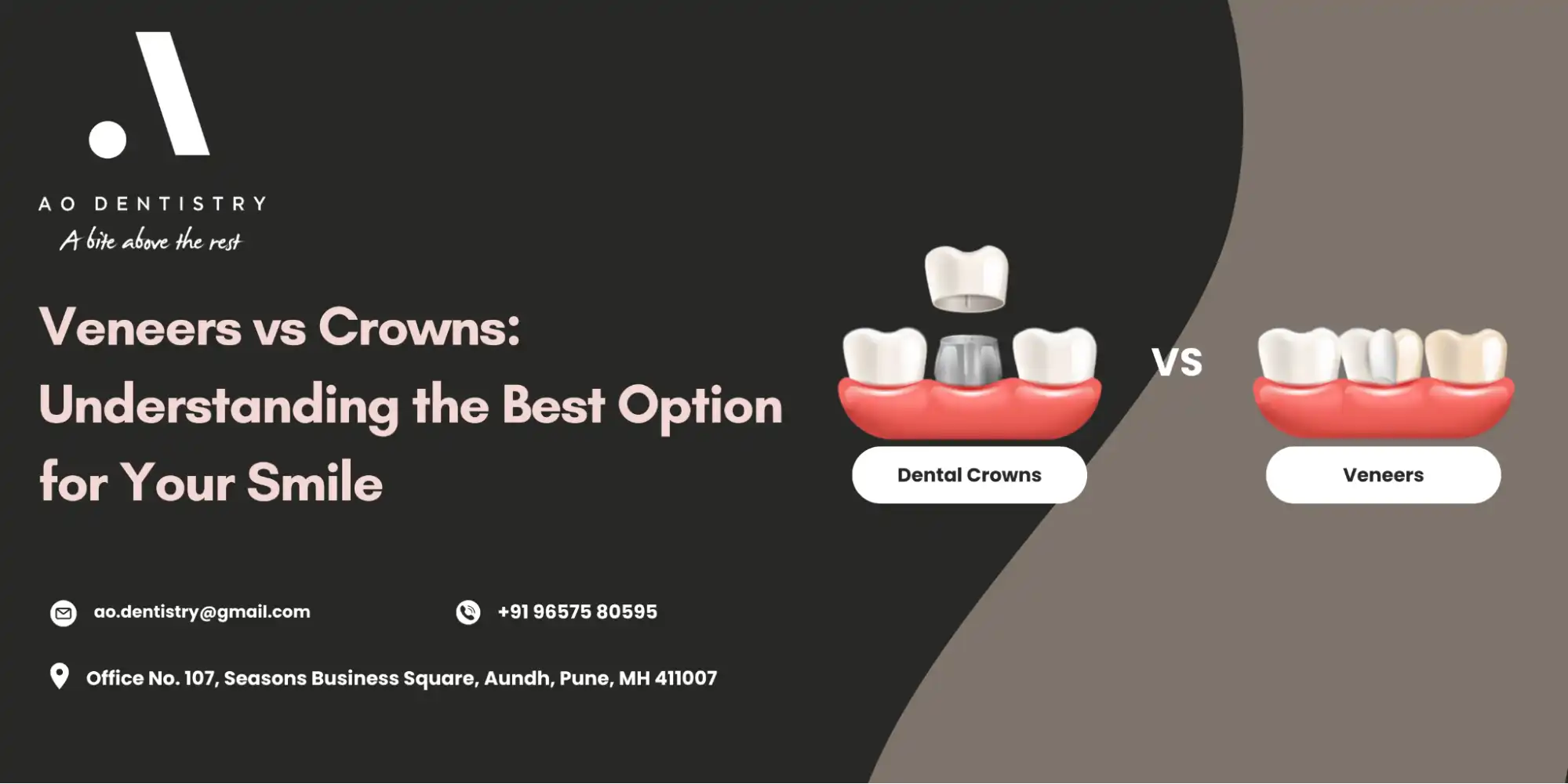Veneers vs Crowns - Key Differences, Benefits & More| AO Dentistry